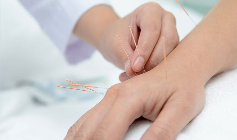 Arthritis and Acupuncture: How This Ancient Practice Can Relieve Modern ...